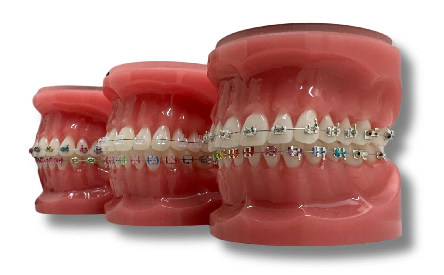Orthodontic Braces, Metal Braces, Ceramic Braces in Encino, CA